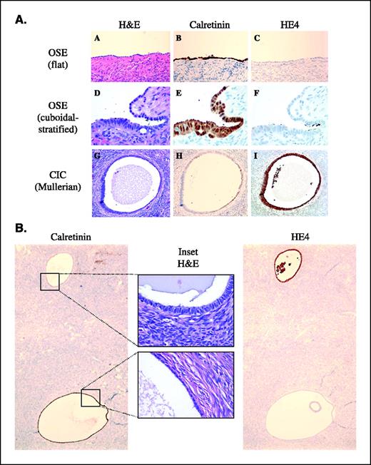 Human Epididymis Protein 4 (HE4) Is a Secreted Glycoprotein that Is ...