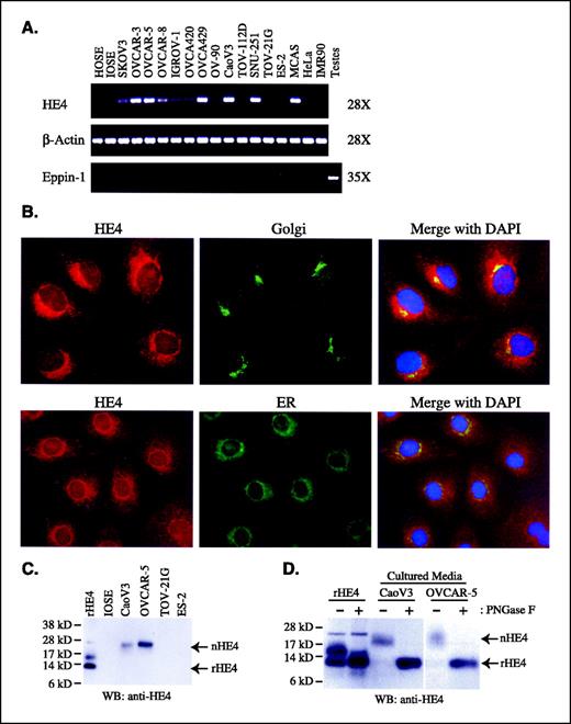 Human Epididymis Protein 4 (HE4) Is a Secreted Glycoprotein that Is ...