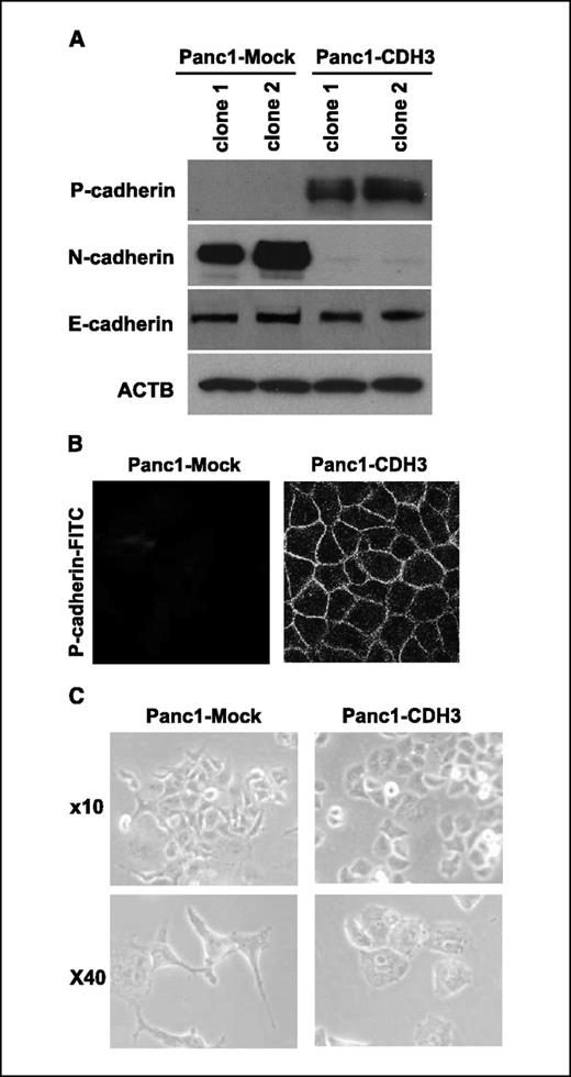 Overexpressed P-Cadherin/CDH3 Promotes Motility of Pancreatic Cancer ...
