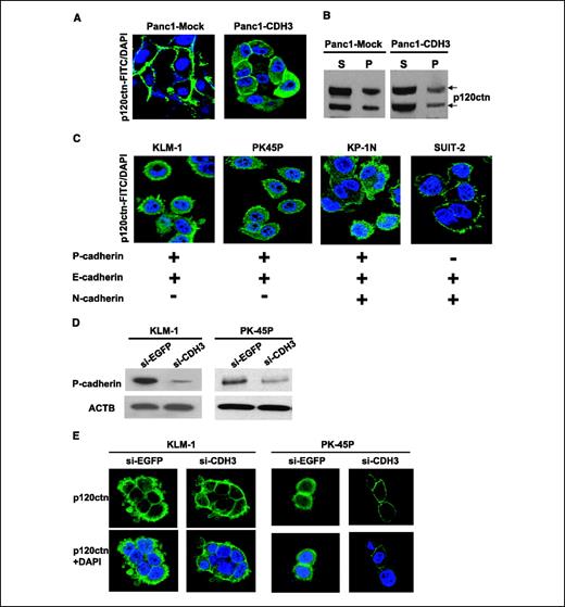 Overexpressed P-Cadherin/CDH3 Promotes Motility of Pancreatic Cancer ...