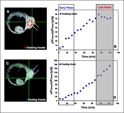 Lymph Node Metastasis in Breast Cancer Xenografts Is Associated with ...