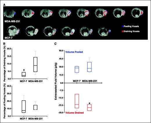 Lymph Node Metastasis in Breast Cancer Xenografts Is Associated with ...