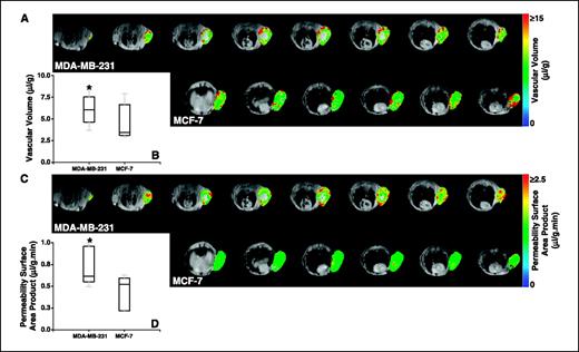 Lymph Node Metastasis in Breast Cancer Xenografts Is Associated with ...
