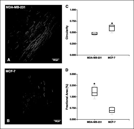 Lymph Node Metastasis in Breast Cancer Xenografts Is Associated with ...