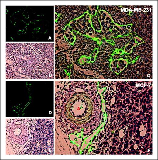 Lymph Node Metastasis in Breast Cancer Xenografts Is Associated with ...