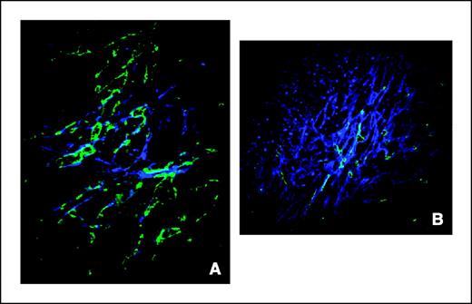 Lymph Node Metastasis in Breast Cancer Xenografts Is Associated with ...
