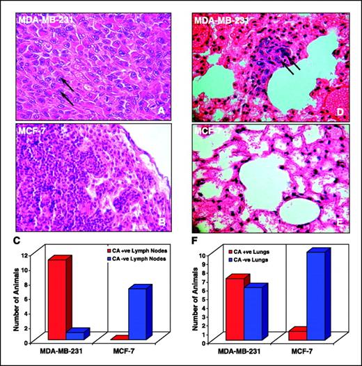 Lymph Node Metastasis in Breast Cancer Xenografts Is Associated with ...