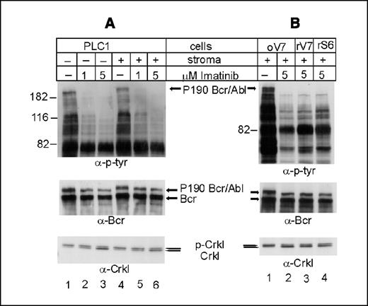 Resistance to Imatinib of Bcr/Abl P190 Lymphoblastic Leukemia Cells | Cancer Research | American ...