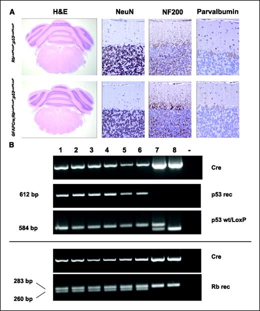 Lack of Rb and p53 Delays Cerebellar Development and Predisposes to ...