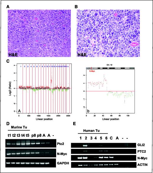 Lack of Rb and p53 Delays Cerebellar Development and Predisposes to ...