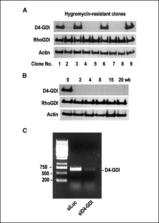 D4-GDI, a Rho GTPase Regulator, Promotes Breast Cancer Cell ...