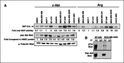 Activation of Abl Tyrosine Kinases Promotes Invasion of Aggressive ...