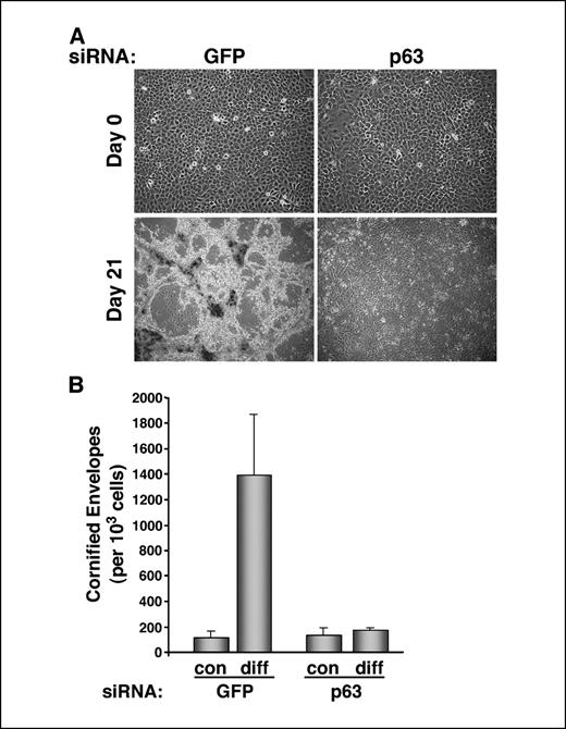 Loss of p63 Leads to Increased Cell Migration and Up-regulation of ...