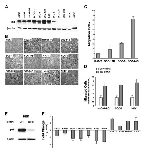 Loss of p63 Leads to Increased Cell Migration and Up-regulation of ...