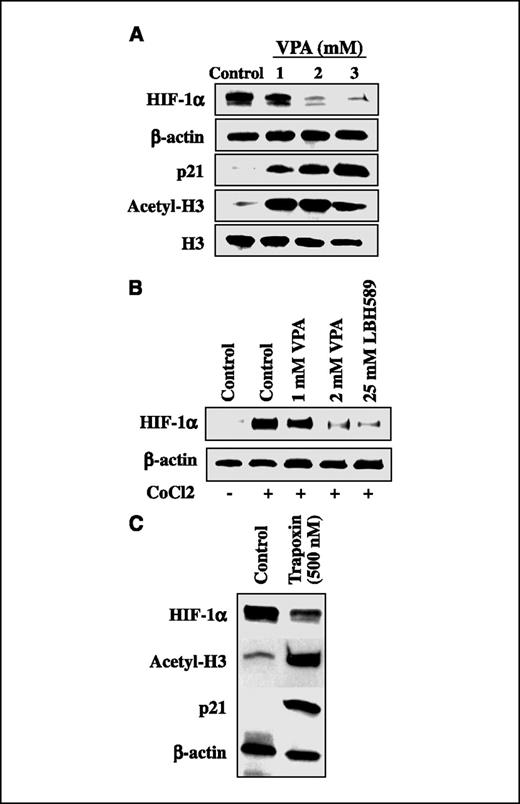 Class II Histone Deacetylases Are Associated with VHL-Independent ...