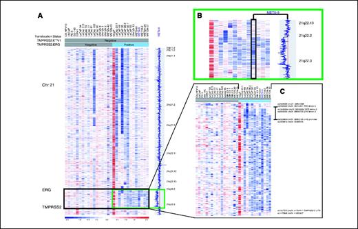 TMPRSS2:ERG Fusion-Associated Deletions Provide Insight into the ...