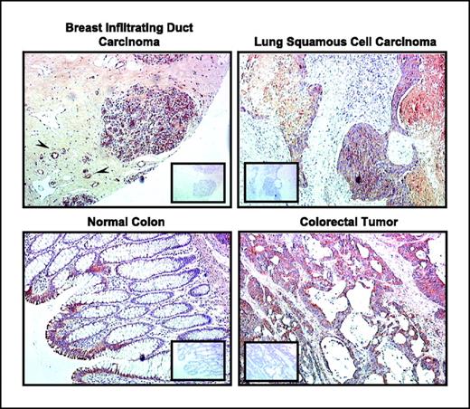 Targeting the Lymphotoxin-β Receptor with Agonist Antibodies as a ...