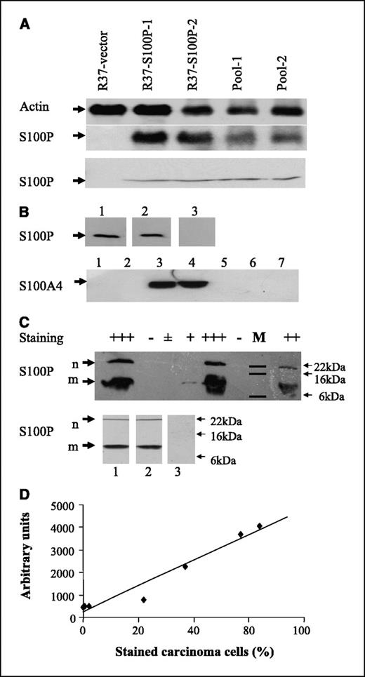 Induction of Metastasis by S100P in a Rat Mammary Model and Its ...