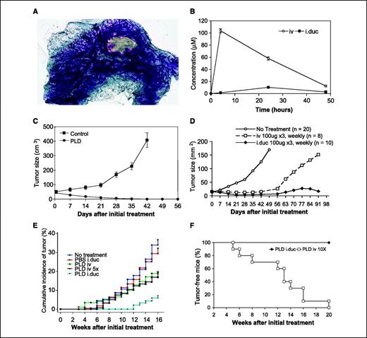 Ductal Access for Prevention and Therapy of Mammary Tumors | Cancer ...