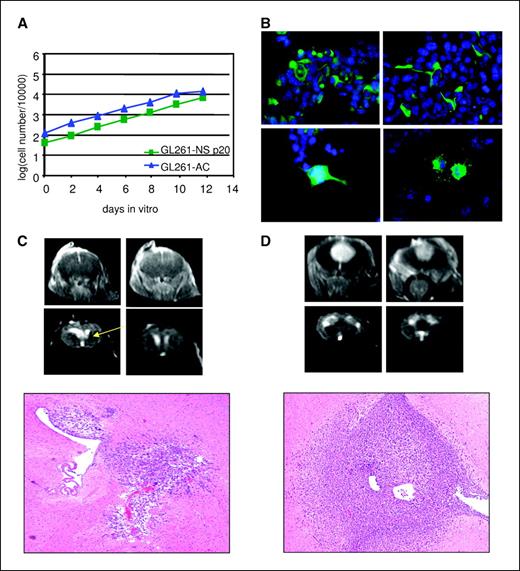 Neurospheres Enriched in Cancer Stem–Like Cells Are Highly Effective in ...