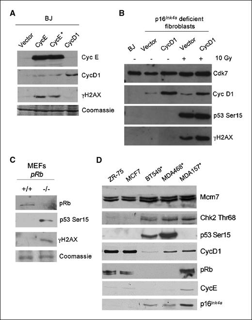 Retinoblastoma Pathway Defects Show Differential Ability to Activate ...