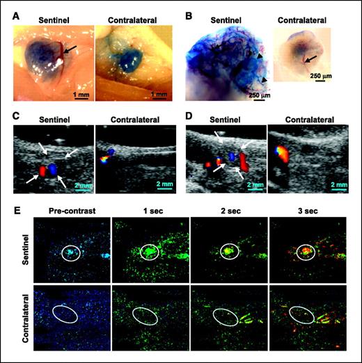 Preparing the “Soil”: The Primary Tumor Induces Vasculature ...