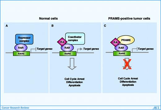 A Causal Role for the Human Tumor Antigen Preferentially Expressed ...