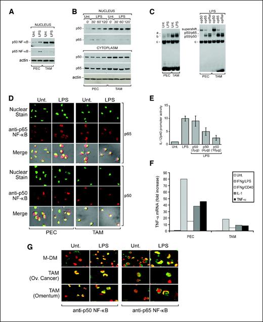 p50 Nuclear Factor-κB Overexpression in Tumor-Associated Macrophages ...