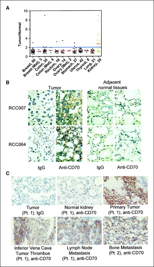 Lymphocyte Activation Antigen CD70 Expressed by Renal Cell Carcinoma Is ...