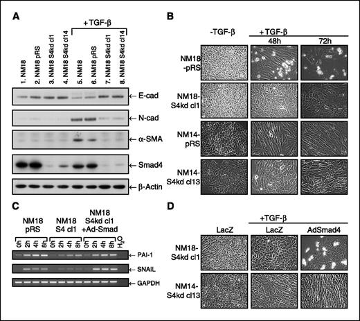 The Tumor Suppressor Smad4 Is Required for Transforming Growth Factor β ...