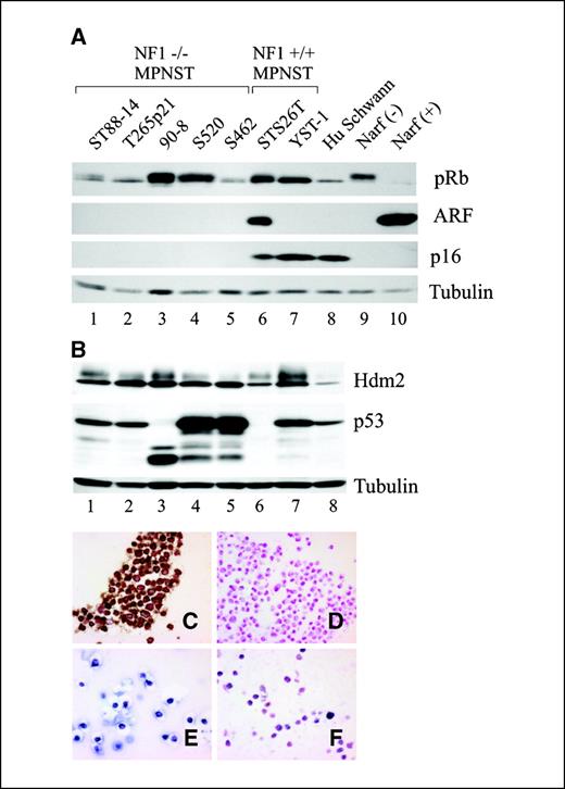 Large-Scale Molecular Comparison of Human Schwann Cells to Malignant ...