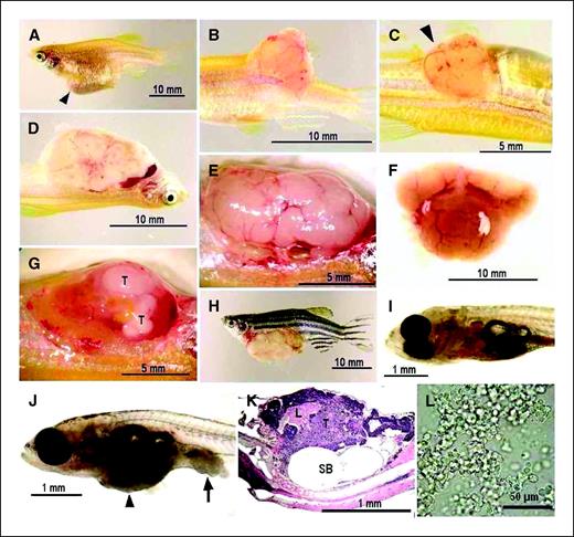 Transplantable Tumor Lines Generated in Clonal Zebrafish | Cancer ...