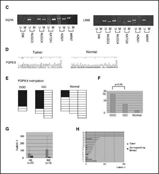 PGP9.5 Methylation in Diffuse-Type Gastric Cancer | Cancer Research ...