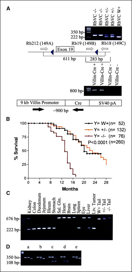 Inactivation of Conditional Rb by Villin-Cre Leads to Aggressive Tumors ...