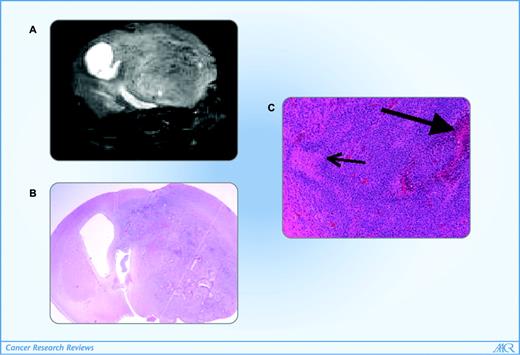 Genetically Engineered Models Have Advantages over Xenografts for ...