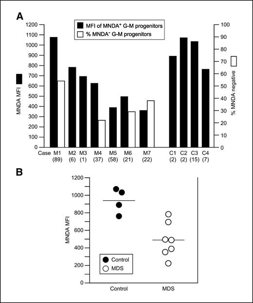 Dysregulated Human Myeloid Nuclear Differentiation Antigen Expression ...