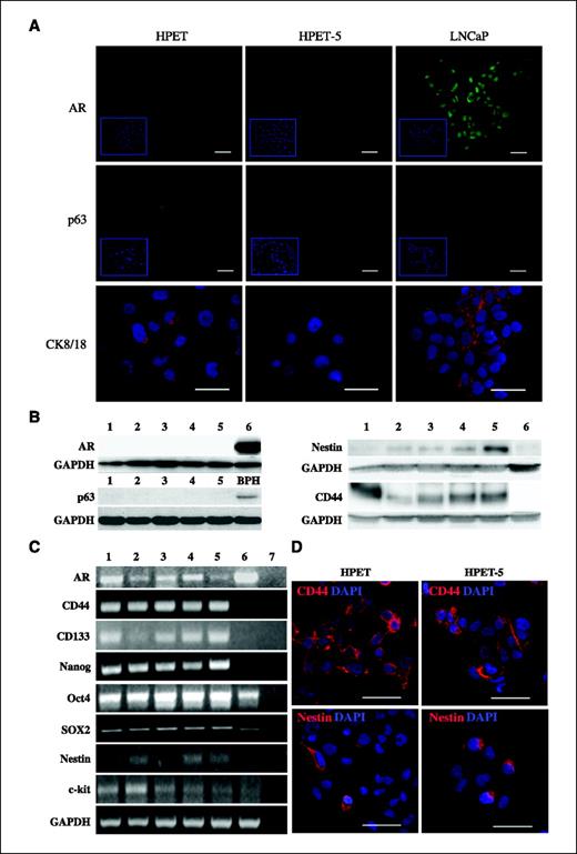 Prostate Cancer Cells with Stem Cell Characteristics Reconstitute the ...