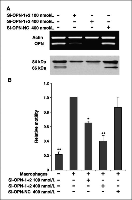 Human Macrophages Promote the Motility and Invasiveness of Osteopontin ...