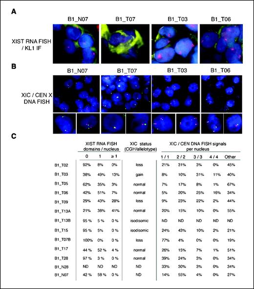 X Inactive–Specific Transcript RNA Coating and Genetic Instability of ...