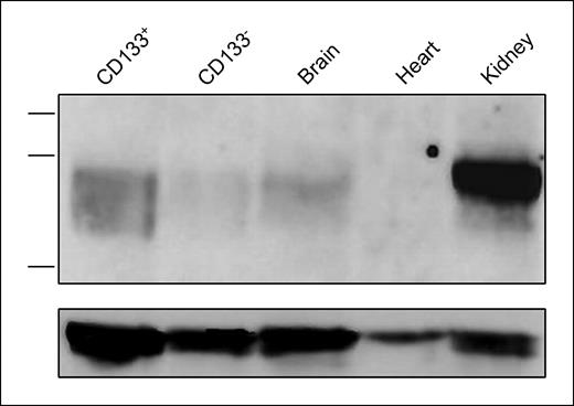 CD133 Is Not Present on Neurogenic Astrocytes in the Adult ...