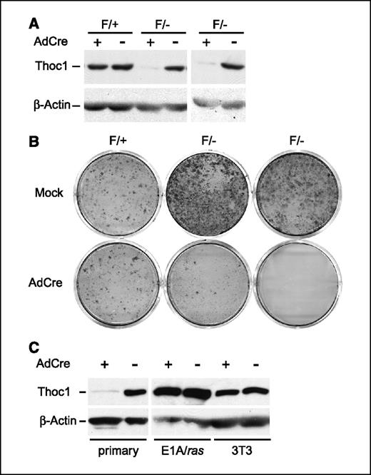 Cancer Cells and Normal Cells Differ in Their Requirements for Thoc1 | Cancer Research ...