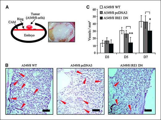 IRE1 Signaling Is Essential for Ischemia-Induced Vascular Endothelial ...
