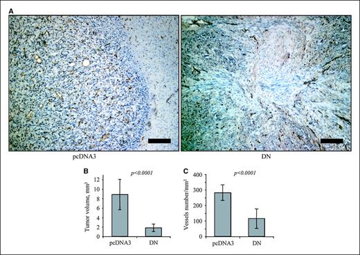 IRE1 Signaling Is Essential for Ischemia-Induced Vascular Endothelial ...