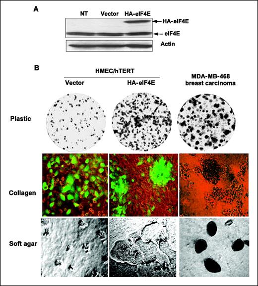 Eukaryotic Translation Initiation Factor 4E–Induced Progression of ...