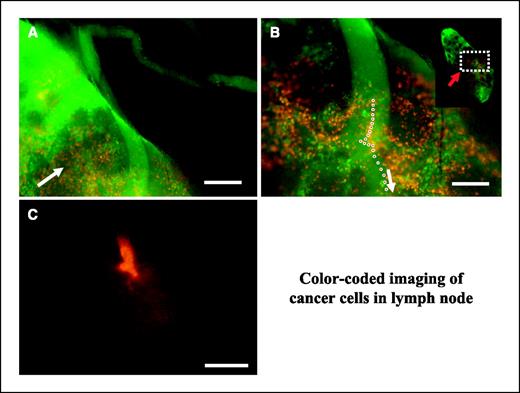 Real-time Imaging of Tumor-Cell Shedding and Trafficking in Lymphatic ...