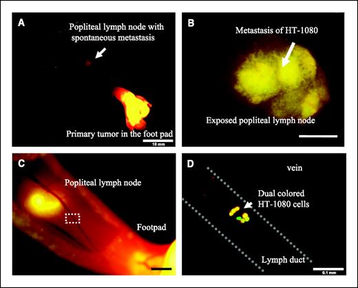 Real-time Imaging of Tumor-Cell Shedding and Trafficking in Lymphatic ...