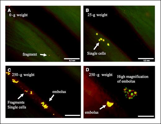 Real-time Imaging of Tumor-Cell Shedding and Trafficking in Lymphatic ...