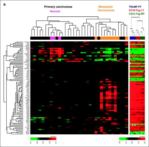 Identification of an Integrated SV40 T/t-Antigen Cancer Signature in ...