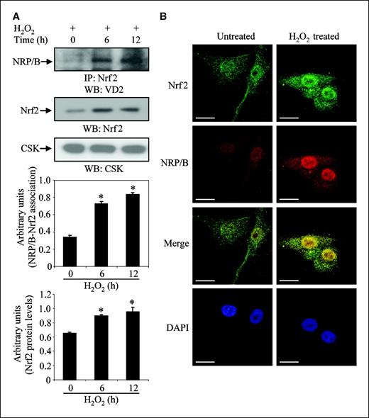 The Nuclear Matrix Protein, NRP/B, Enhances Nrf2-Mediated Oxidative Stress Responses in Breast ...