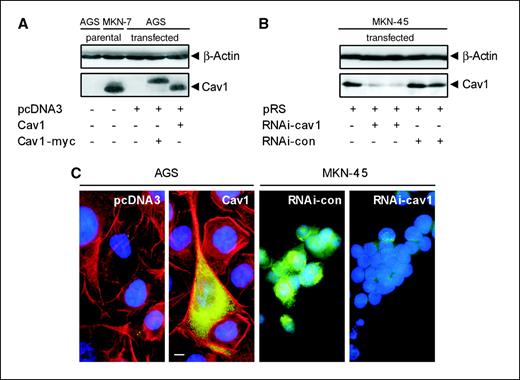 Differential Expression and Function of Caveolin-1 in Human Gastric ...